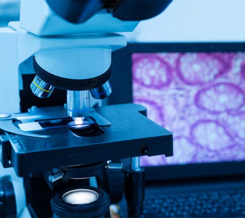Anatomic Pathology – Analyze Pathology